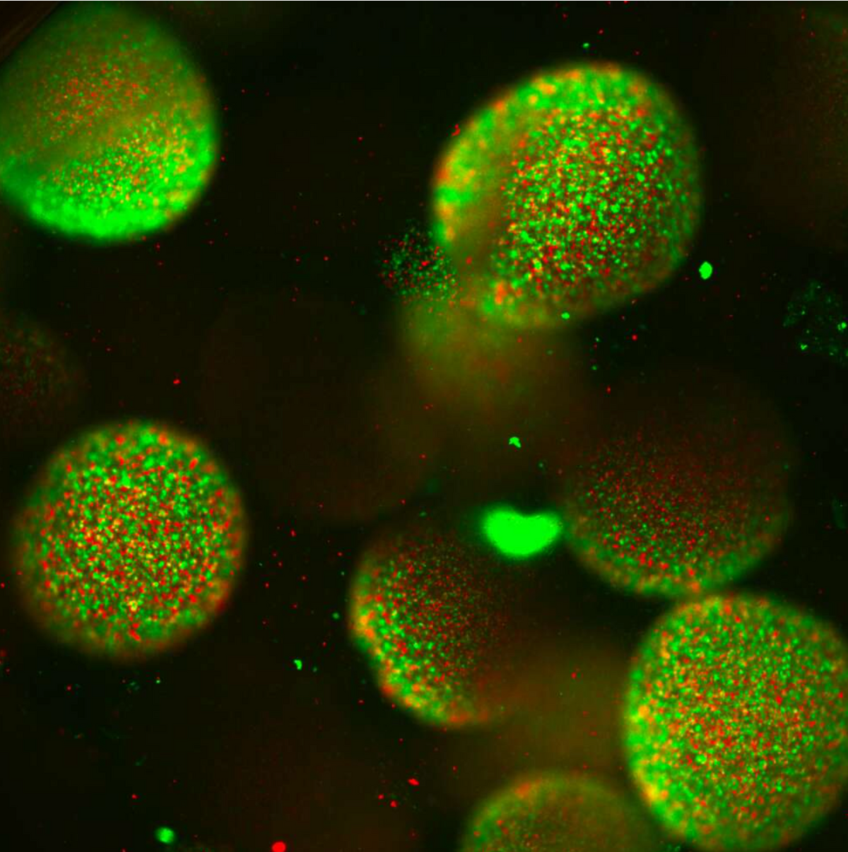Household Sponges Grow Bacteria Better Than Petri Dishes | SpongeBath